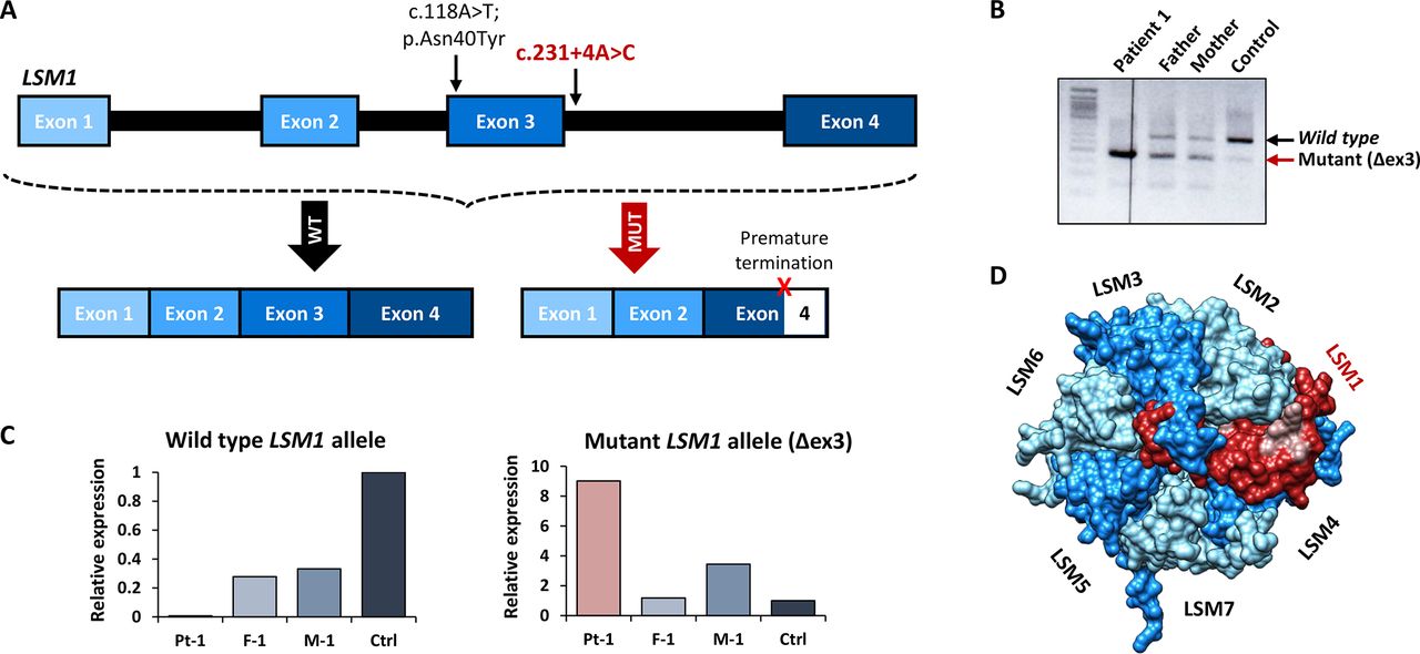 LSM1 c.231+4A>C hotspot variant is associated with a novel ...